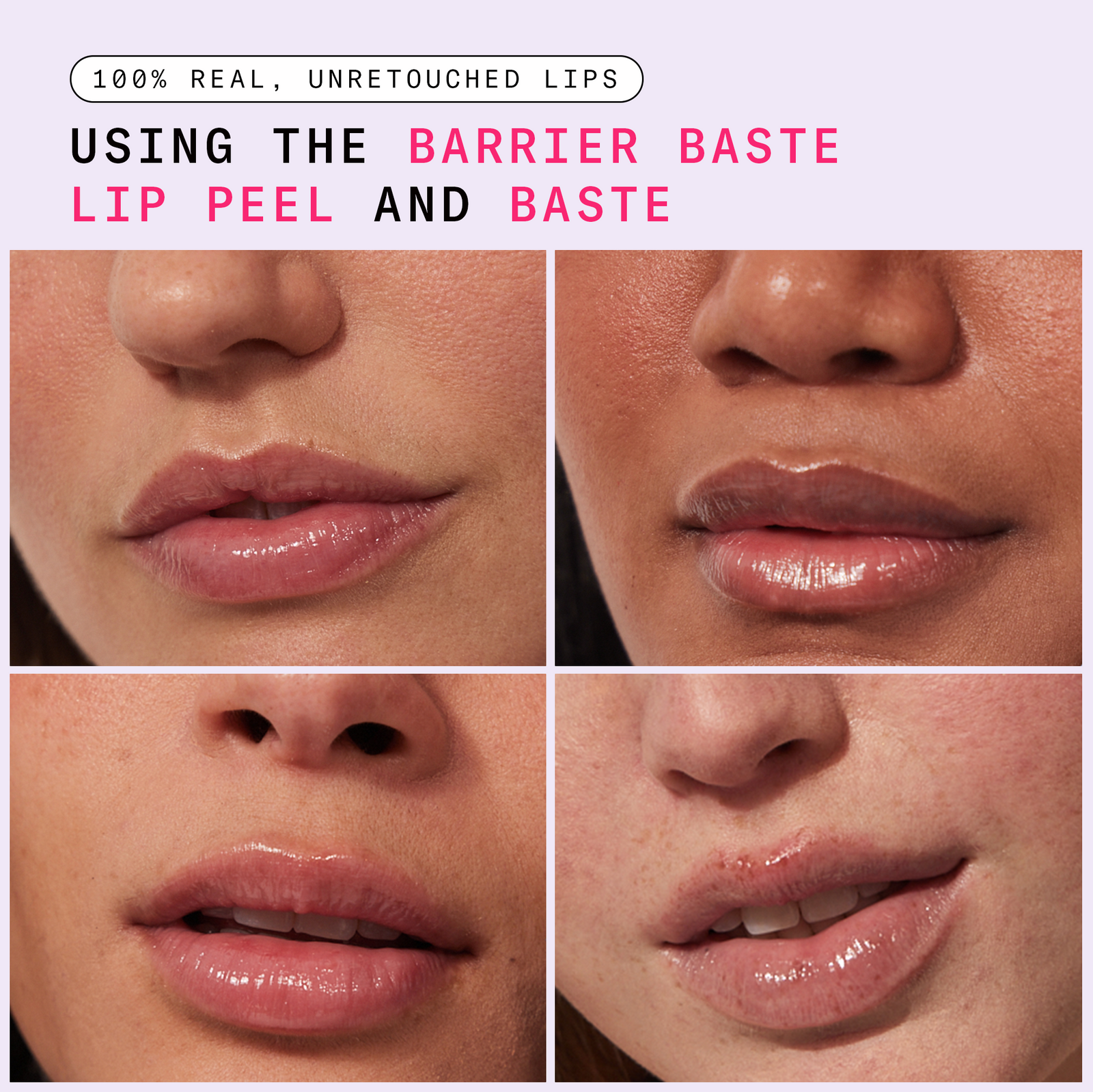 Barrier Baste Lip Basting Duo | Exfoliate & Hydrate Dry Lips – Dr. Idriss
