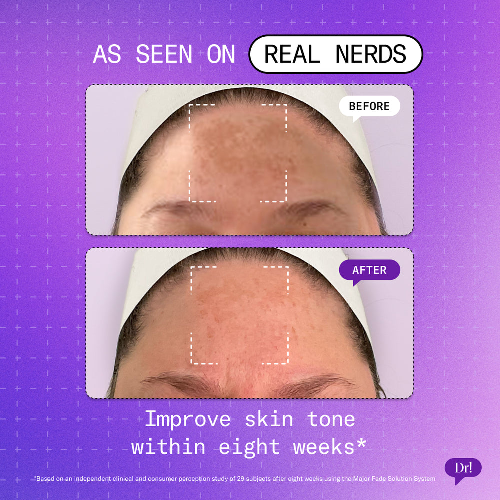 Major Fade Hyper Serum | Brightening Serum for Discoloration – Dr. Idriss