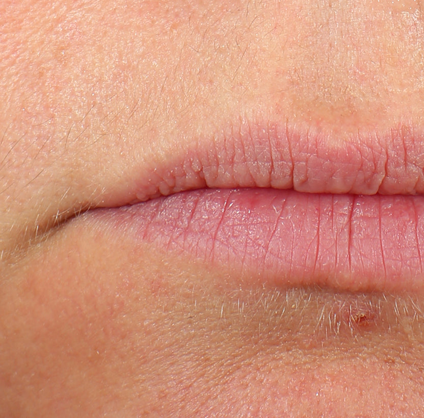 Barrier Baste Lip Basting Duo | Exfoliate & Hydrate Dry Lips – Dr. Idriss
